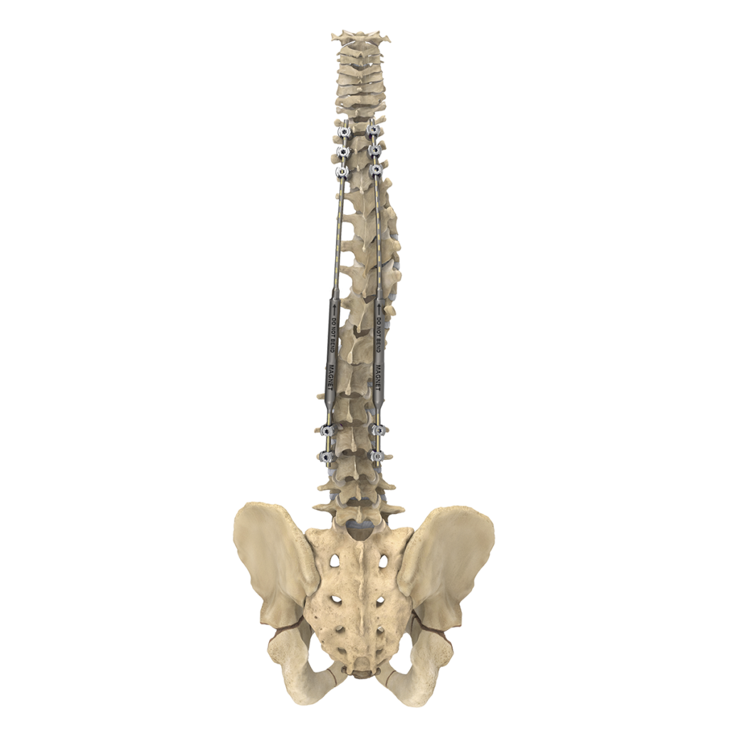 NuVasive Italy - NuVasive